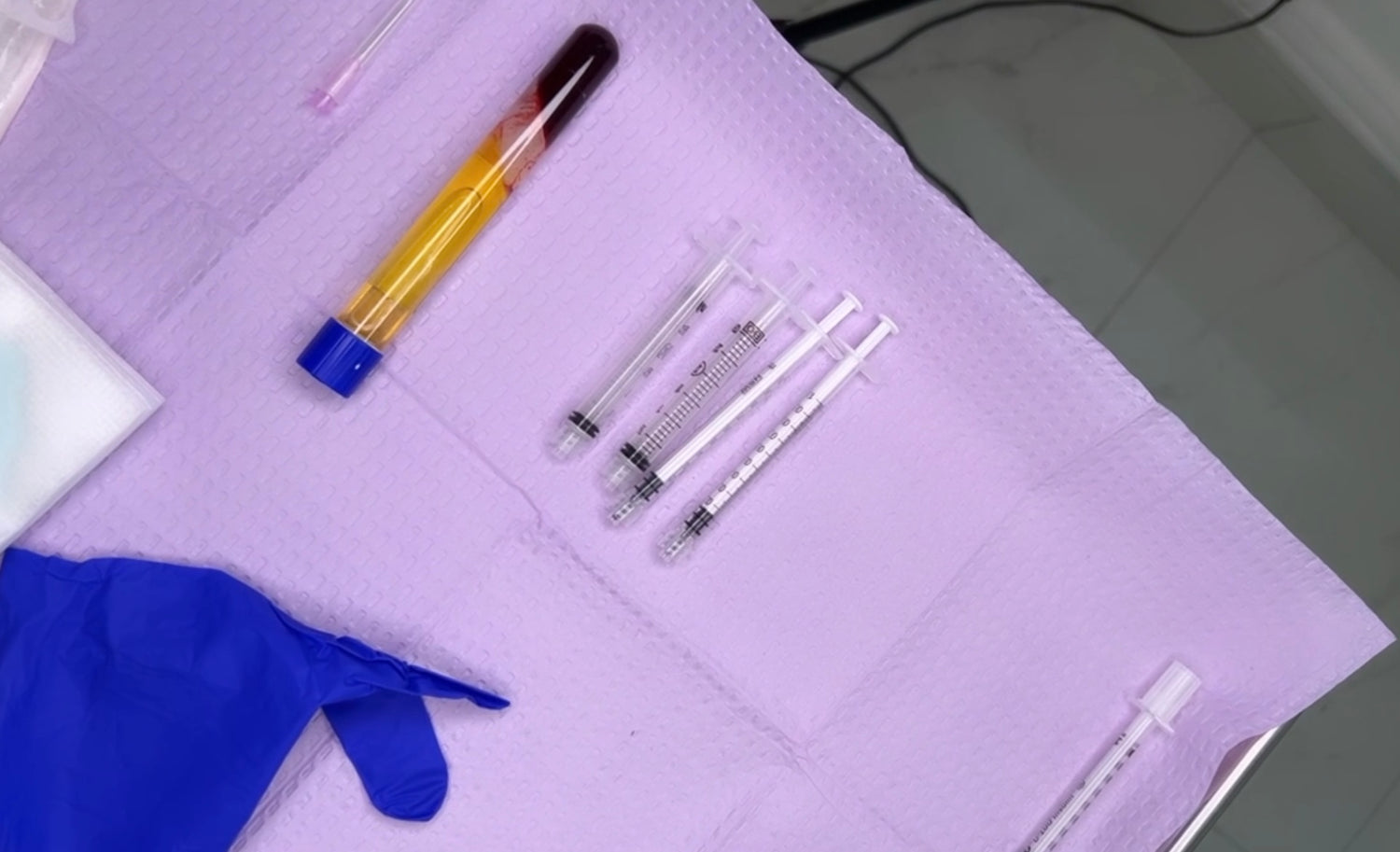 PRP Faq Envy Cosmetic Clinic prp-faq-envy-cosmetic-clinic